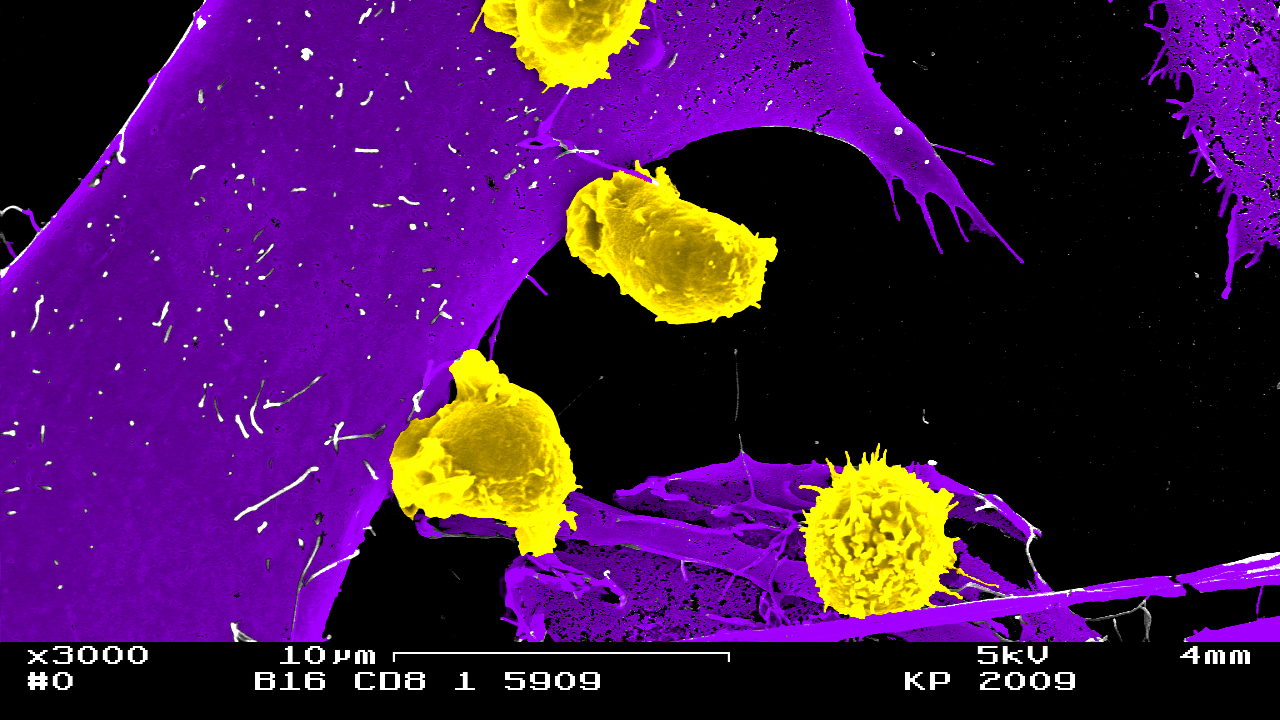 invIOs’s EPiC cell therapy platform to progress development of novel ...